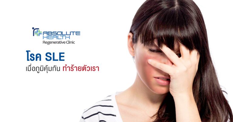 SLE Treatment | Lupus Management Bangkok
